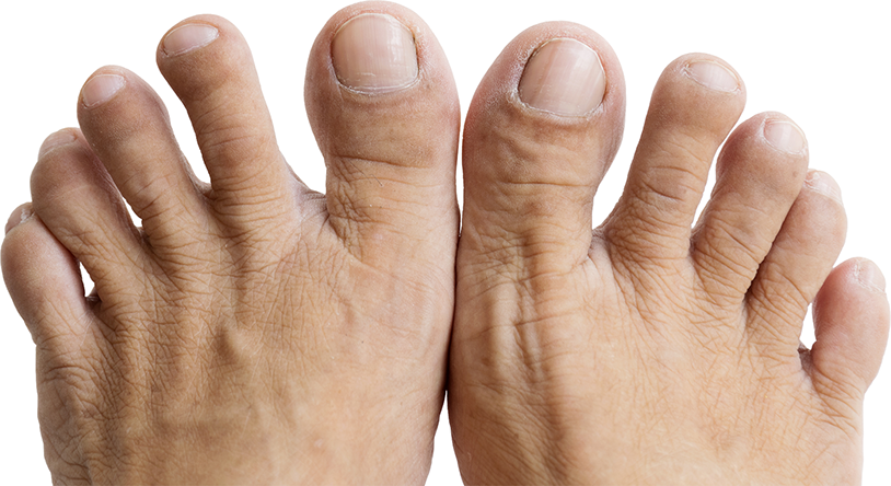 Complicaties | Diatesse